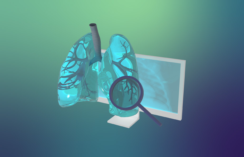 Der neue KI.Demonstrator Pneumo.AI unterstützt bei medizinischer ...